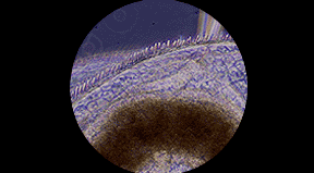 Phase Contrast - Virtual Fluorescent Microscope - Wartburg Biology ...