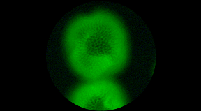 FITC Example - Eye P{iece - Virtual Fluorescent Microscope - Wartburg ...